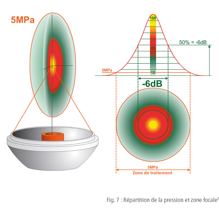 En quoi consistent les ondes de choc ? Physique et technique